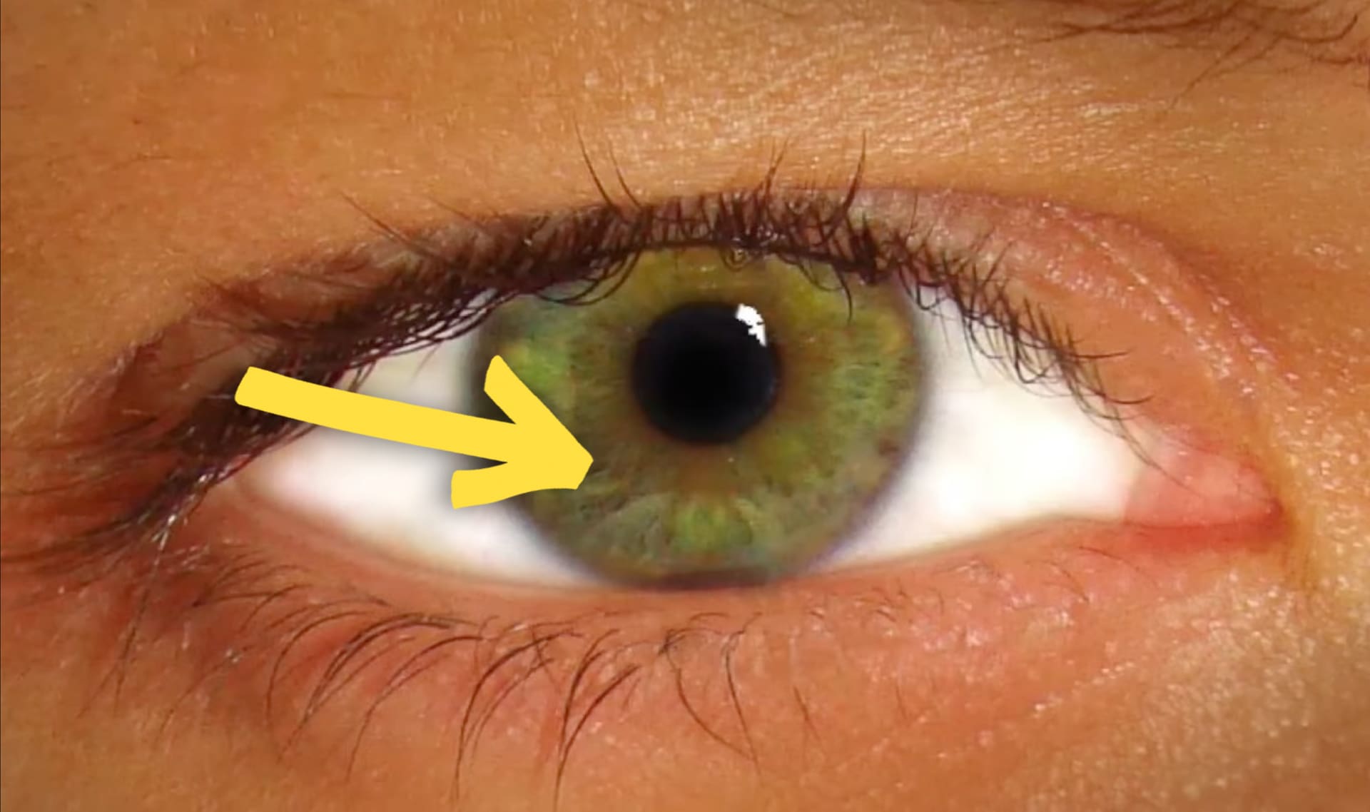 What do people who are blind see?