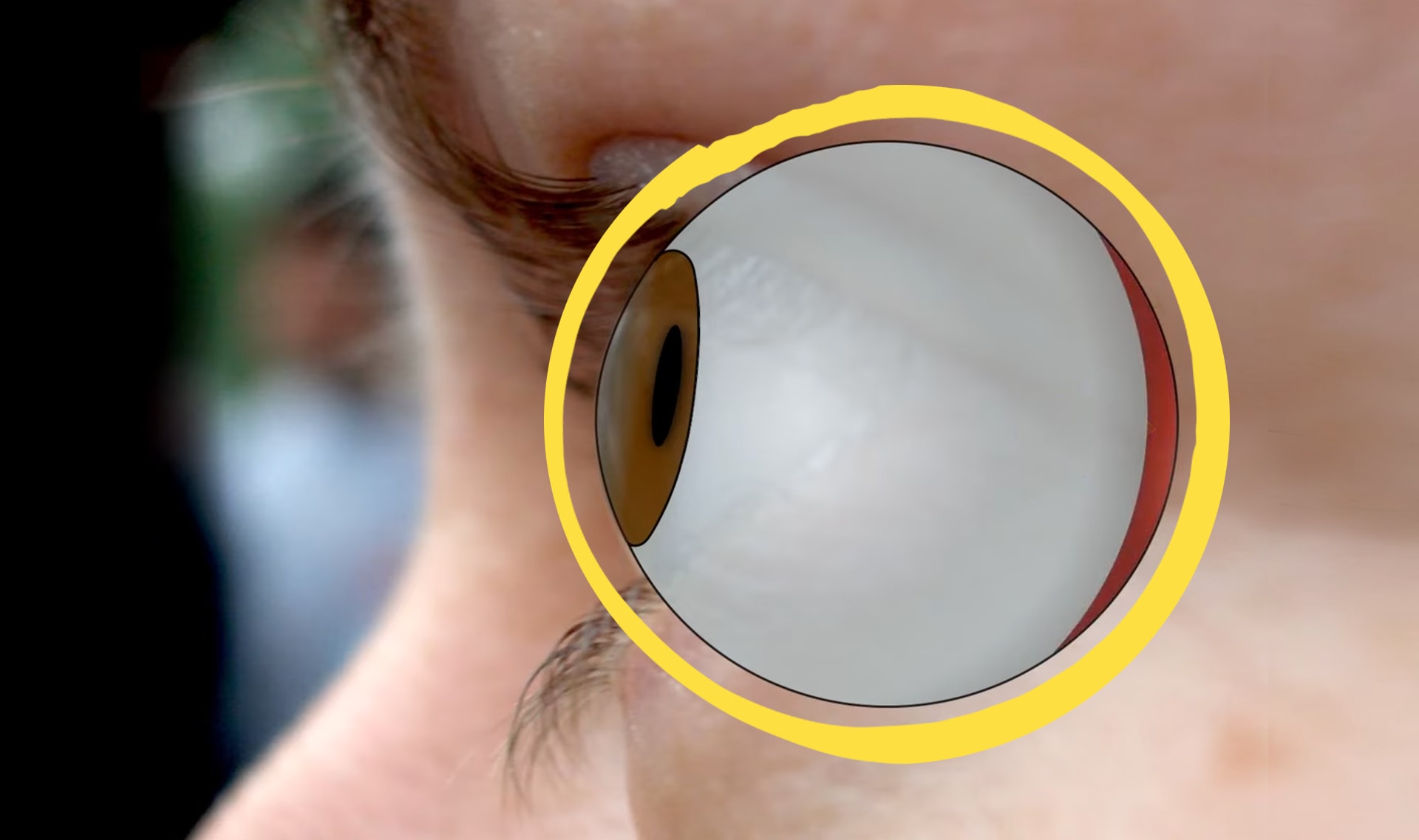 What do people who are blind see?