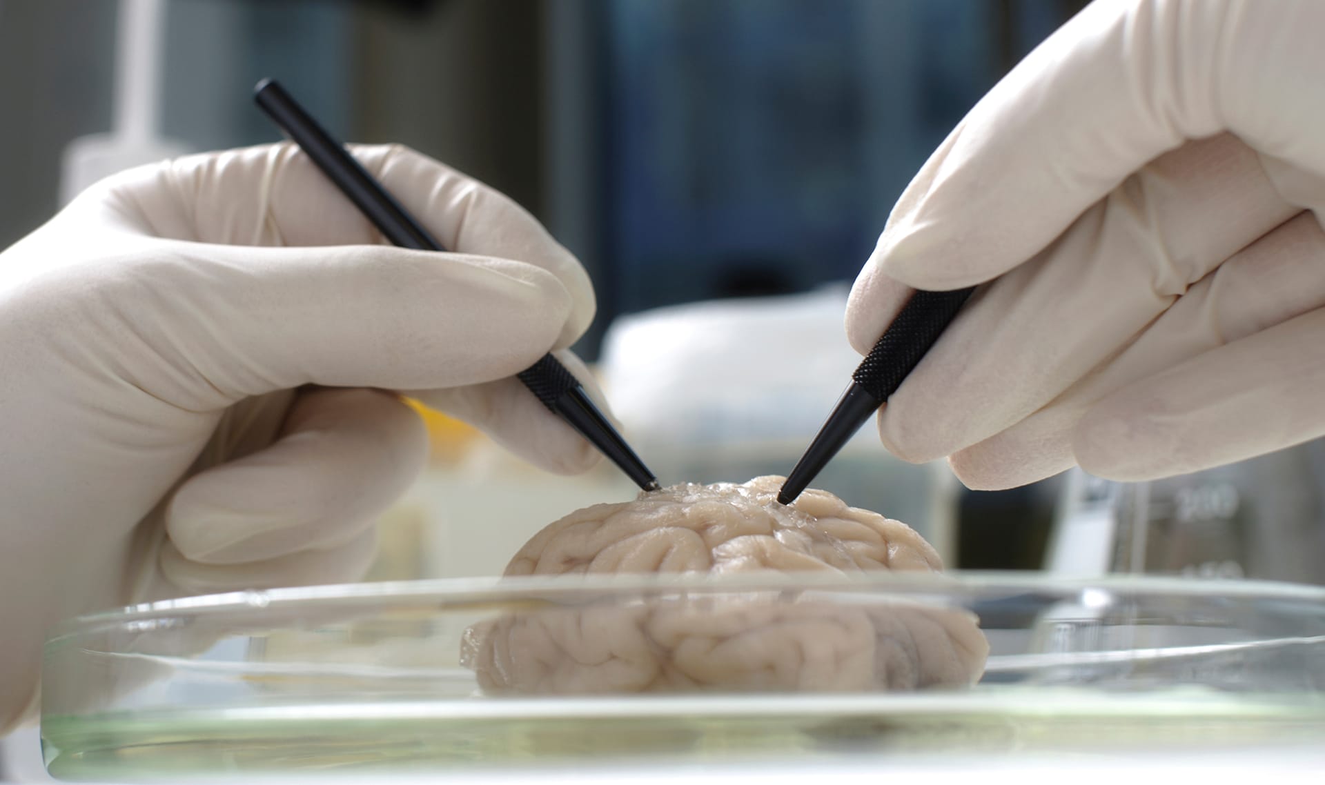 How does your brain control your body?