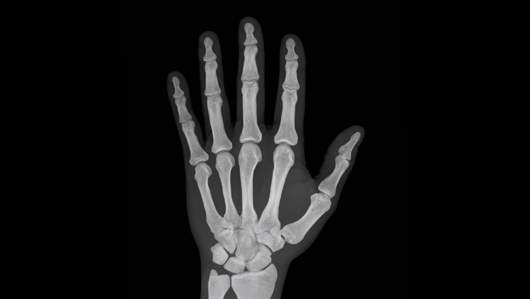 Why do our skeletons have so many bones? - Mystery Science